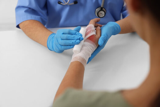 Common Types of Burn Injuries and Their Causes - O’Brien & Ford Buffalo ...